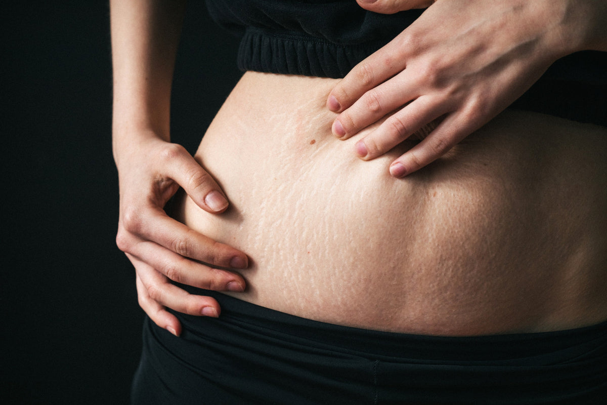 Maternity Bump Bands Prevent Stretch Marks – Valeome